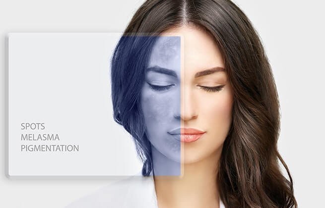 Melasyl™– skuteczny składnik aktywny na przebarwienia| La Roche-Posay